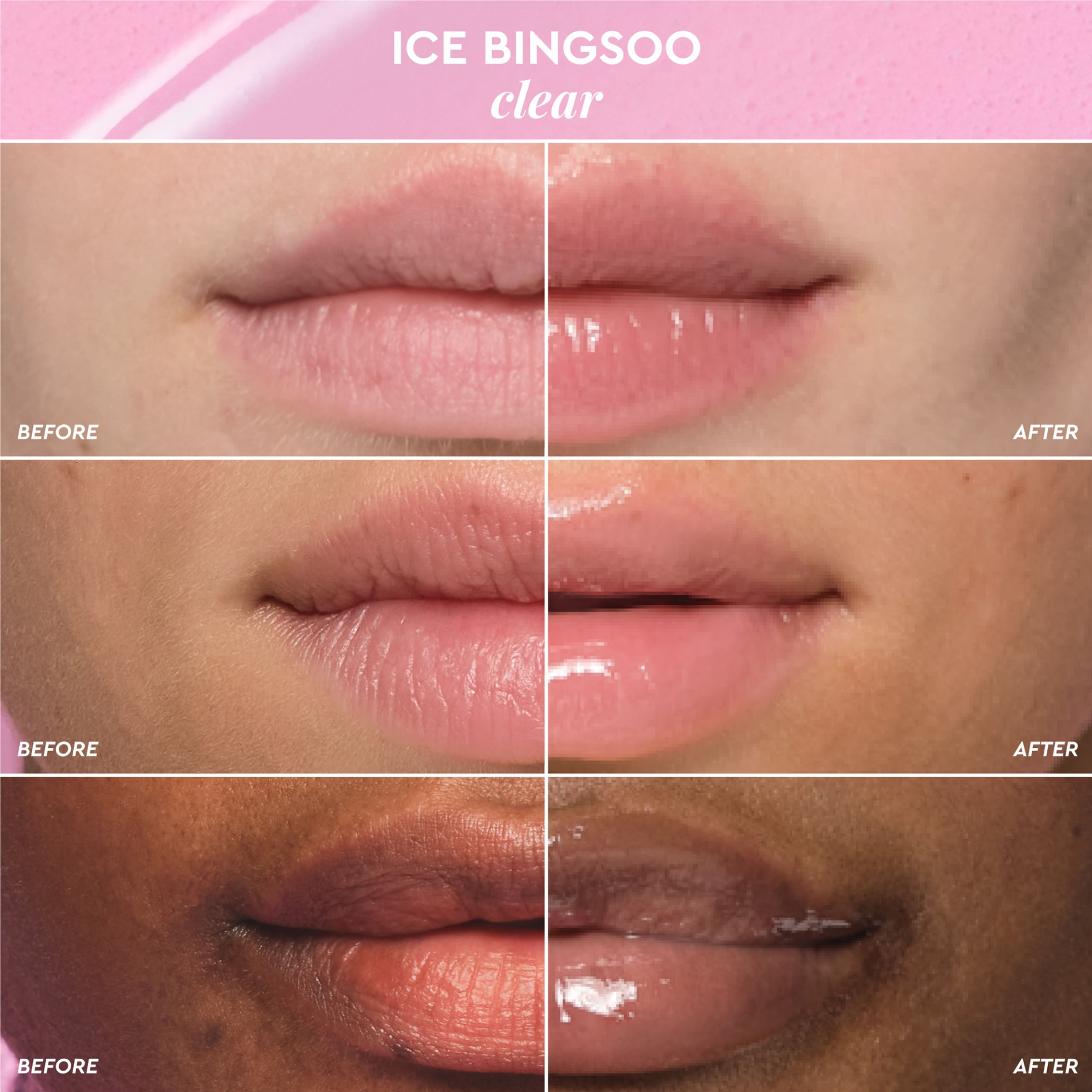 Tratamiento de Labios Glass Balm Lip Treatment - Blackberry Bingsoo ...